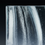 Mirage XL Textured Glass anti-microbial glass for Healthcare